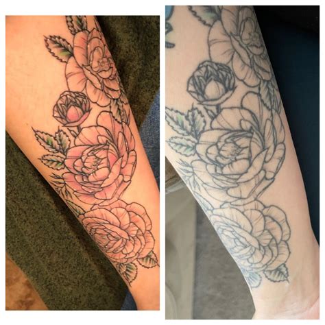 Why Does My Colored Tattoo Look Faded