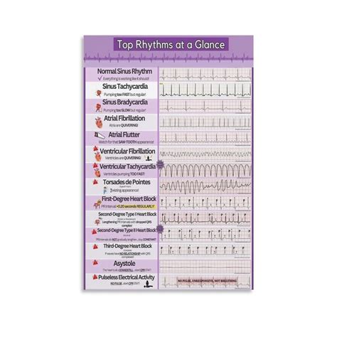 Ekg And Ecg Rhythms Poster Medical Student Poster Canvas Wall Art