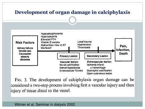 Ppt Calciphlaxis Or Warfain Induced Skin Necrosis Powerpoint