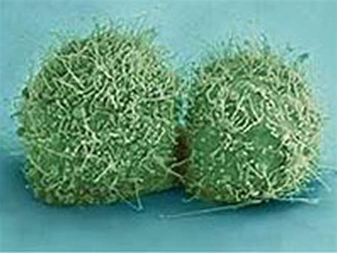 中国临床肿瘤学会乳腺癌诊疗指南2017版于7日发布