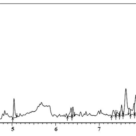 Gcms Chromatogram Showing Chemical Constituents Of N Hexane Extract Of