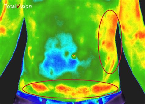 Why Thermography For Health Monitoring Haelan Products Inc