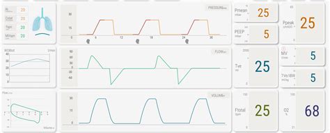 Ventilator Monitoring Parameters Basic Mediklik One Healthcare