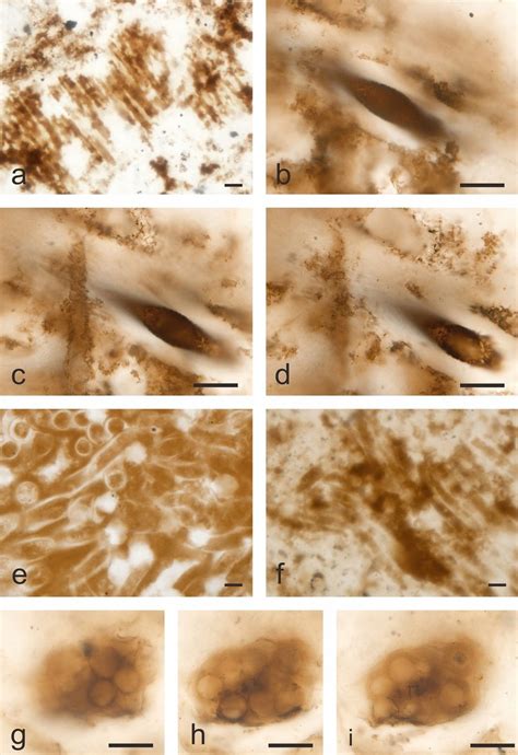 Cyanobacteria Fossils In Chert From Well Yj1x Yijianfang Formation Download Scientific