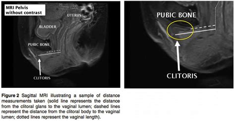 The Clitoris Is Basically A Tiny Penis The Fact Base