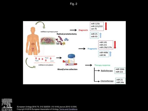 The Potential Of Micrornas As Prostate Cancer Biomarkers Ppt Download