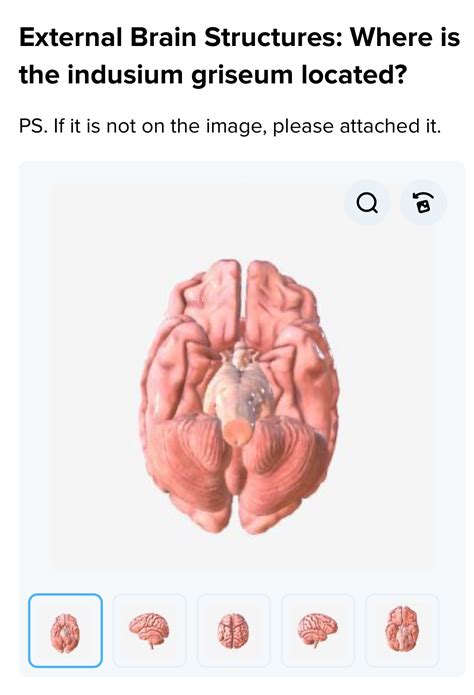 Solved External Brain Structures Where Is The Indusium