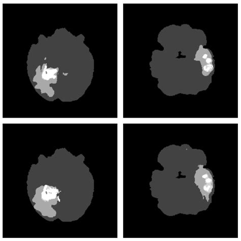 Handling Unbalanced Data In Deep Image Segmentation By Dong Chen Medium