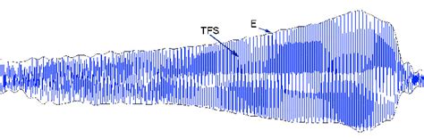 Temporal Fine Structure Tfs And Envelope E Download Scientific Diagram