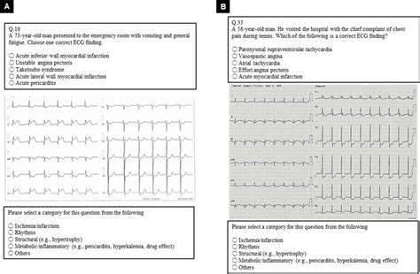 Examples Of Questions Deemed As “appropriate” And “revision” The Ecg