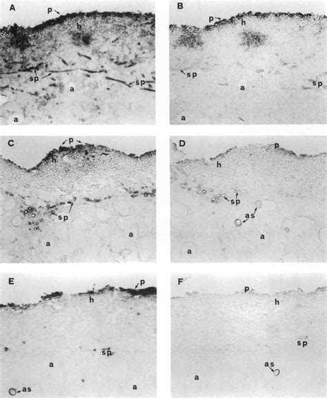 Colocalization Of L Dopa Oxidase Ace And L Tyrosine 3 Monooxygenase