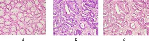 Stain Normalisation A Reference Image B Raw Image C Normalised Download Scientific