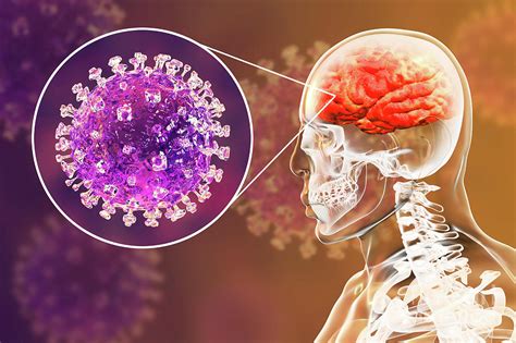 Encephalitis Caused By Nipah Viruses Photograph By Kateryna Kon Science