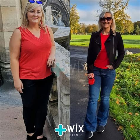 Gastric Sleeve Before And After Wix Clinic