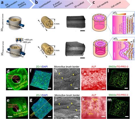 Human Intestines On 3d Porous Silk Scaffolds Ab Schematics Of The Download Scientific