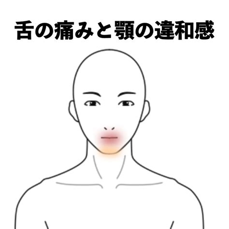 10年来の舌痛症｜舌痛症のツボ｜ツボネット 鍼灸の症例が検索できるツボ辞典