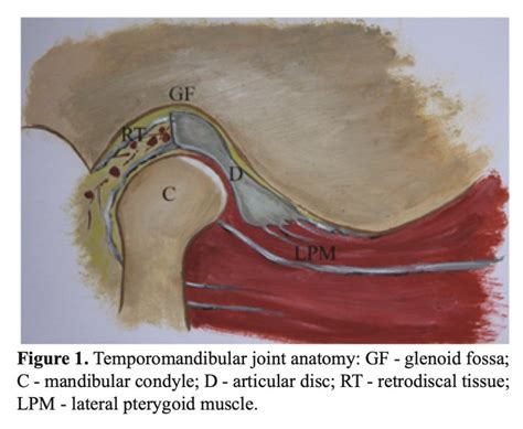 Temporomandibular Joints Temporomandibular Joint Disorders And