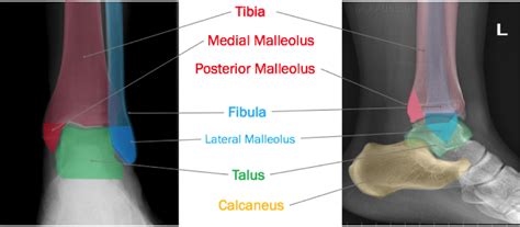 Lateral Malleolus Anatomy