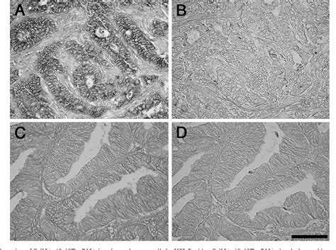 Figure 3 From The Utility Of Formalin Fixed And Paraffin Embedded Tissue Blocks For Quantitative