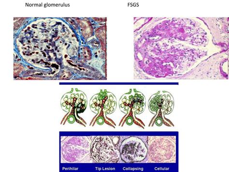 Ppt Glomerular Anatomy And Physiology Powerpoint Presentation Free
