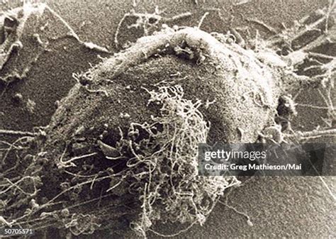 Ebola Microscope Photos And Premium High Res Pictures Getty Images