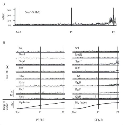 Sample Surface Electromyographic Emg Recordings Are Presented A Download Scientific
