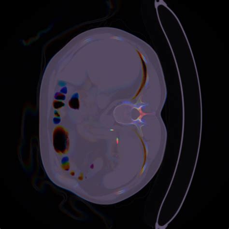 Lesiondetection Object Detection Dataset By Lesion