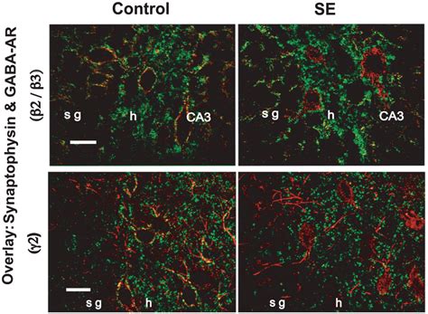 Internalization Of Synaptic Gaba‐a Receptors During Se β2β3 Subunits