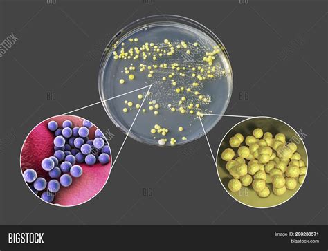 Colonies Bacteria Image Photo Free Trial Bigstock