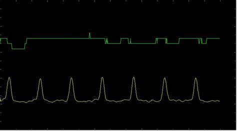 Can Not Read Correct Respiration Waveform With Ads1292r Data Converters Forum Data