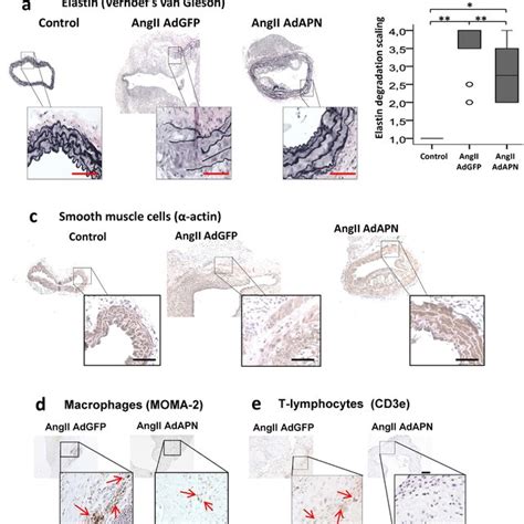Adiponectin Expression And Plasma Adiponectin Levels In Angii Infused