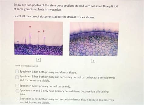 Solved The Drawings Below Are Both Of Eudicot Stem