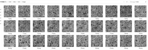 计算机视觉语义分割——u net convolutional networks for biomedical image