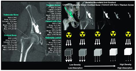Overview Of Hu Principles Underlying Ct Scan Titanium Screw Possesses Download Scientific