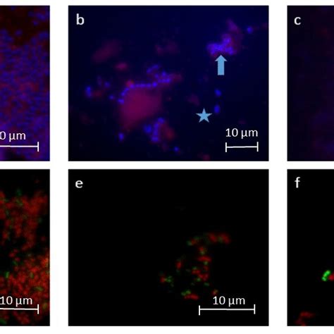 Representative Fluorescence Microscopic Images After Dapi Cona Staining Download Scientific