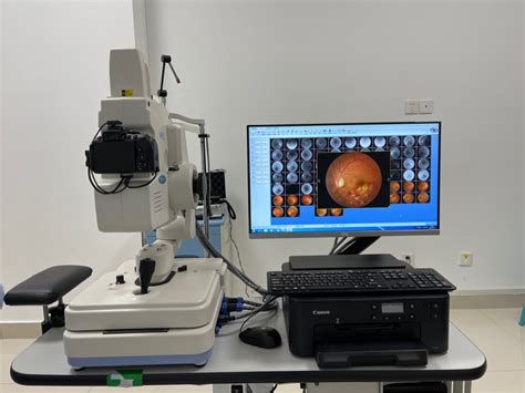 【科普讲堂】新城医院带您了解荧光素眼底血管造影技术