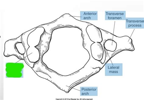 cross sectional anatomy spine flashcards quizlet