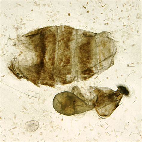 Tortricids Of Agricultural Importance Tortricids Of Agricultural Importance