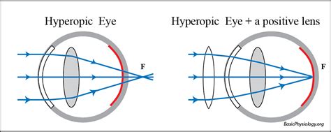 Vision H331a The Eye