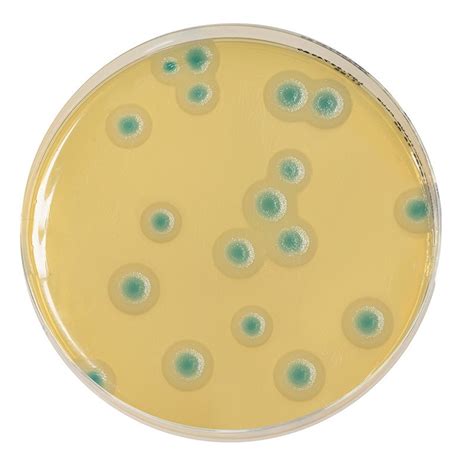 Compass® Bacillus Cereus Agar Rtu Innovation Diagnostics