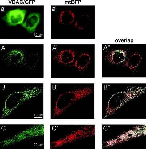 Intracellular Distribution Of Recombinantly Expressed Vdacgfp Hela