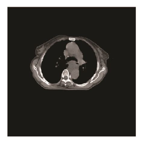 The Registration Results For Chest Images Using The Cpu Based And