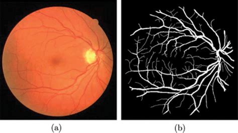 A Example Of Colored Fundus Image And B Binary Map Of The