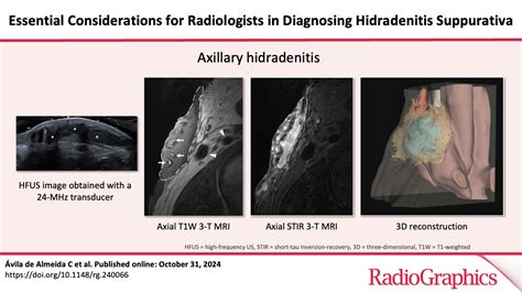 Essential Considerations For Radiologists In Diagnosing Hidradenitis