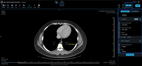 Using The Viewer Ohif