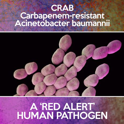 Not All Crabs Are Good — Crab Museum