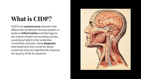 Understanding Cidp Insights Into Life Expectancy And Patient Outcomespdf