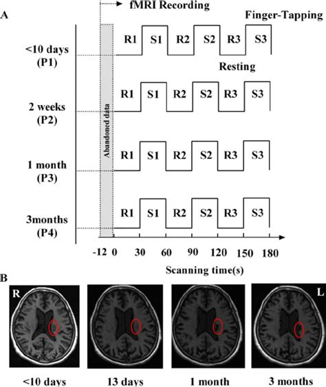 A Diagram Of One Session In FMRI Experiment The FMRI Experiment Download Scientific Diagram