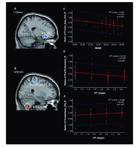 Correlation Of Regional Homogeneity Reho Between Brain Regions And