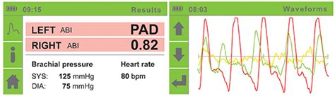 Abi In Diagnostic Process